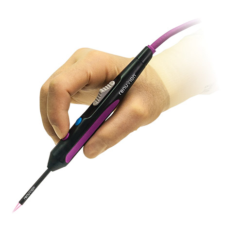 Renuvion - Apyx Medical